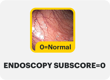 Efficacy - RINVOQ® (upadacitinib) for Ulcerative Colitis